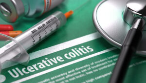 Cos’è la colite ulcerosa o rettocolite ulcerosa?